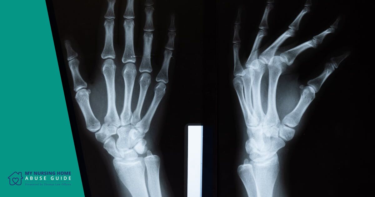 What Do Restraint Injuries Look Like? - My Nursing Home Abuse Guide